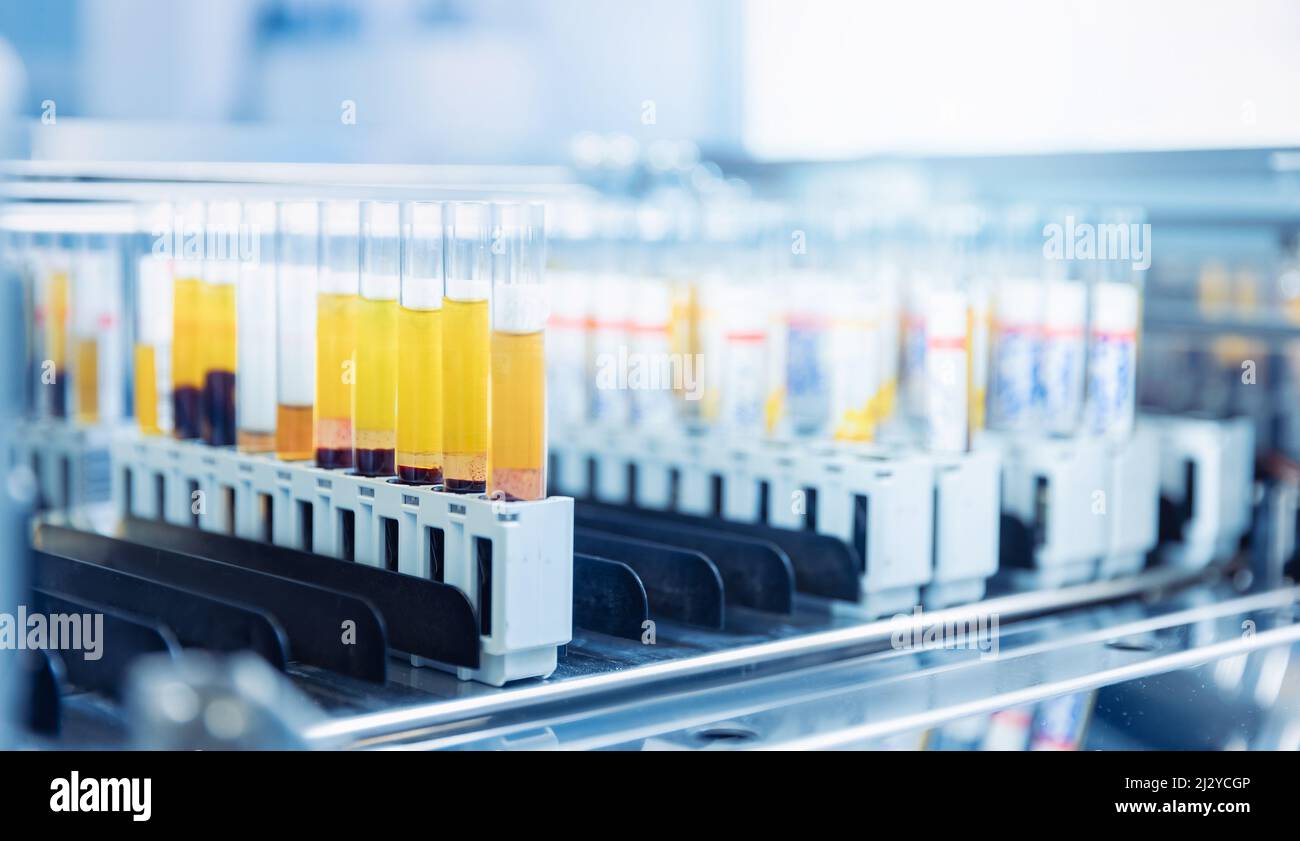 Test tubes with blood for automatic biochemical analyzer. Medical lab ...