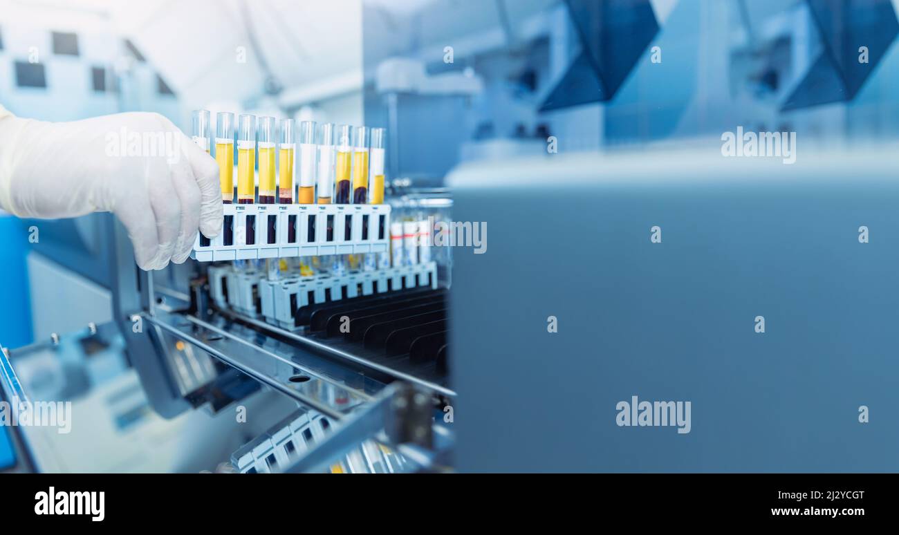 Scientist working with auto robotical machine for testing blood, modern ...