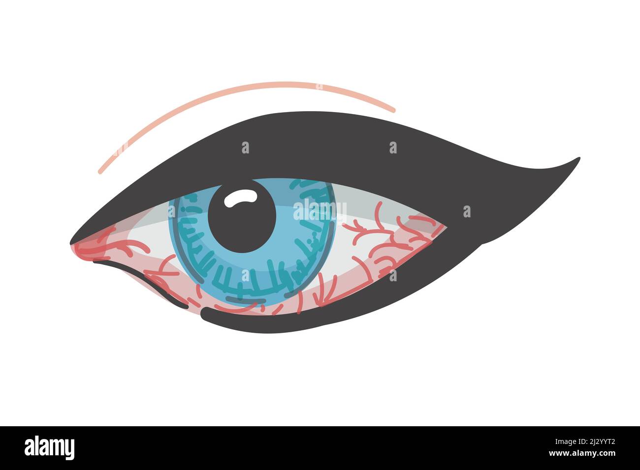 Redness of the eye. Eyeball disease. Vector illustration. Isolated icon ...
