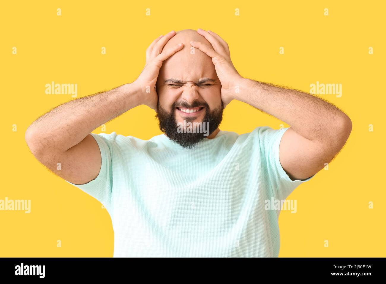 Stressed bald man on yellow background Stock Photo - Alamy