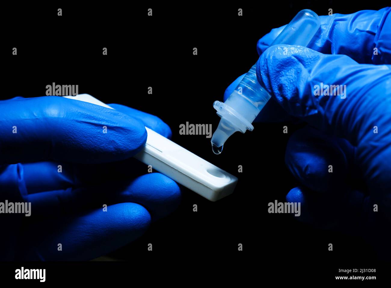 Medical personnel hand placing the secretions sample into the SARS CoV ...