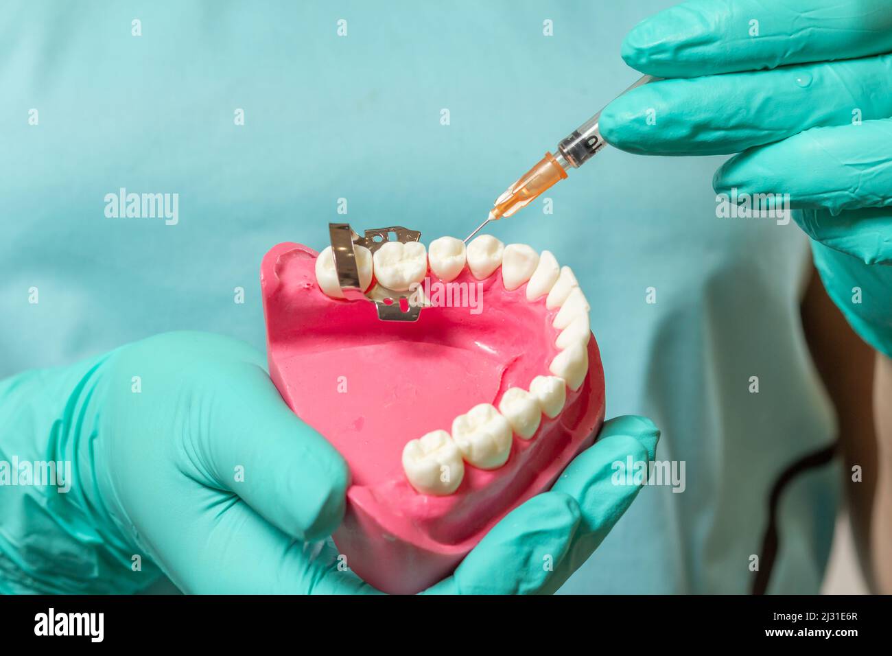 Dentist's hands holding a layout of the human jaw with a dental dam ...