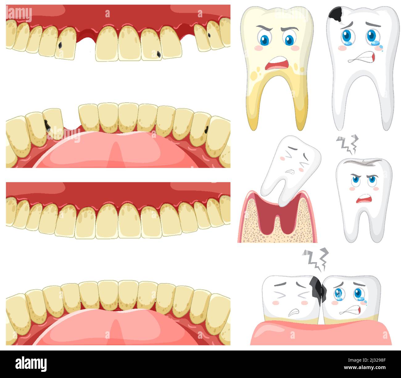 Set of all types of teeth on white background illustration Stock Vector ...