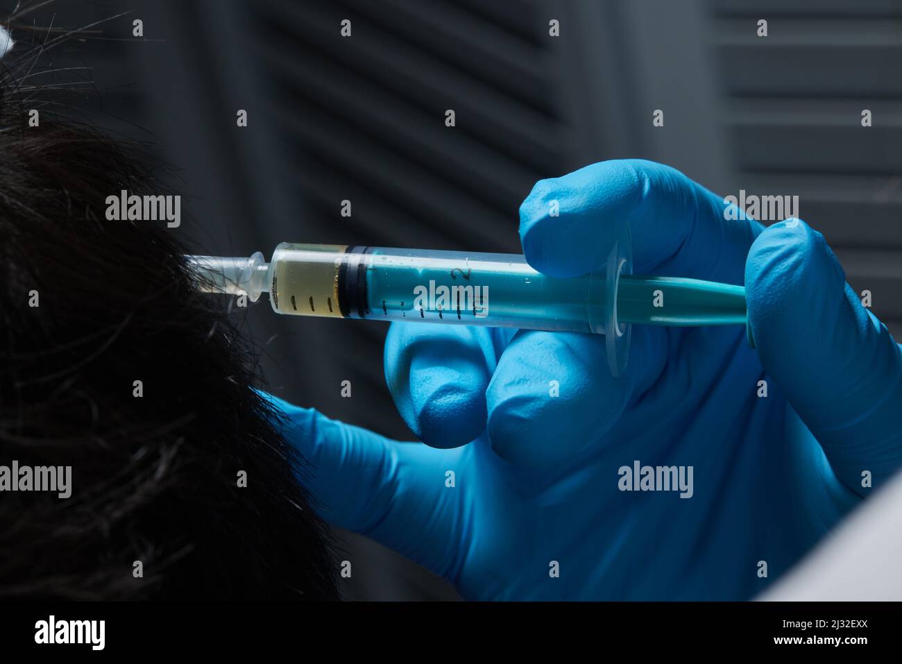 Injection plasma into head hair man cosmetologist doctor Stock Photo ...