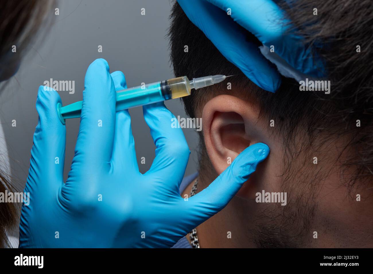 Injection plasma into head hair man cosmetologist doctor Stock Photo ...