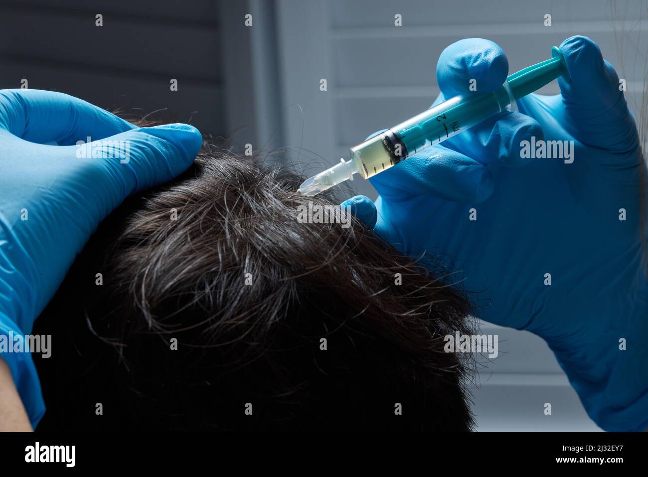 Injection plasma into head hair man cosmetologist doctor Stock Photo ...