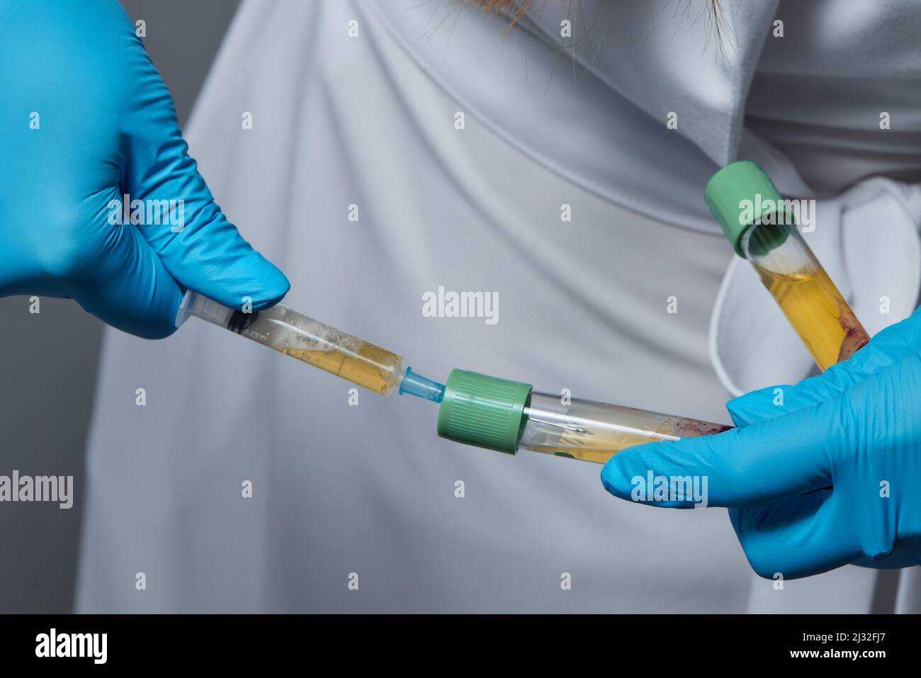Beautician doctor's hands put test tube with blood in centrifuge ...