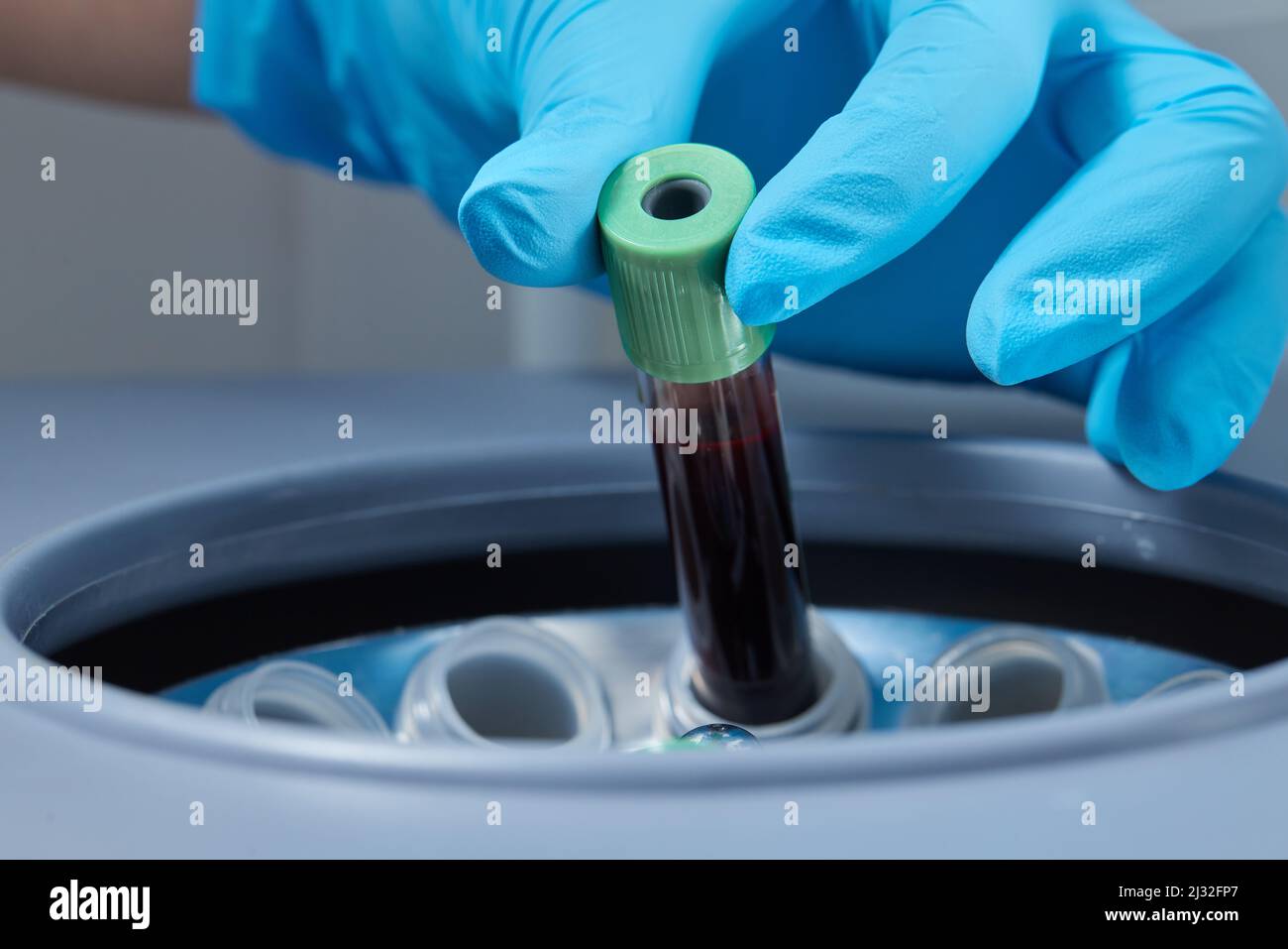 Beautician doctor's hands put test tube with blood in centrifuge ...