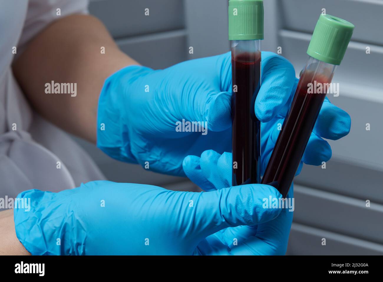 Beautician doctor's hands put test tube with blood in centrifuge ...