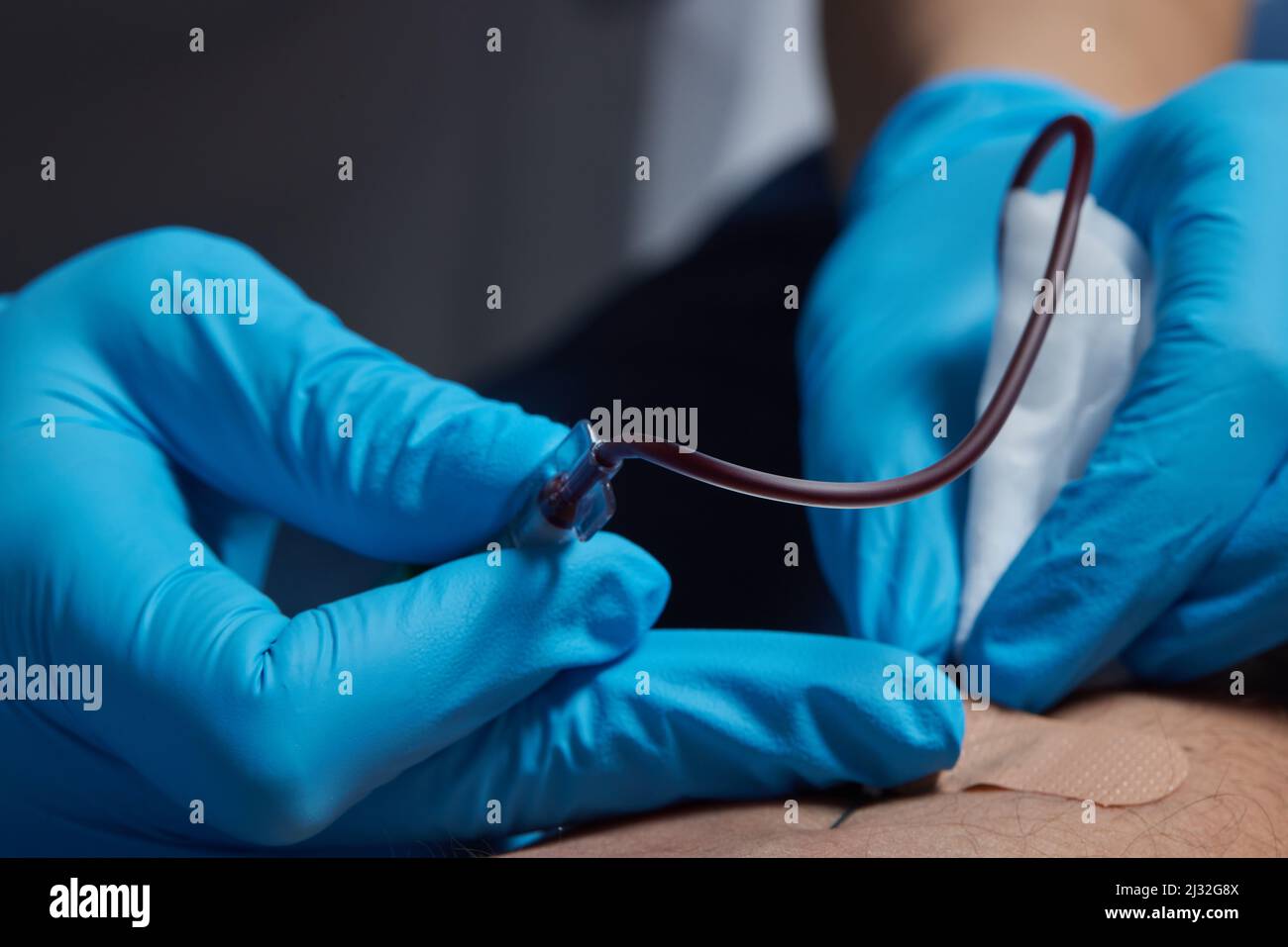 Tuberculosis test arm hi-res stock photography and images - Alamy