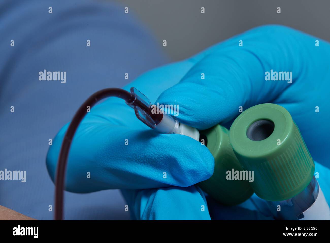 Tuberculosis test arm hi-res stock photography and images - Alamy