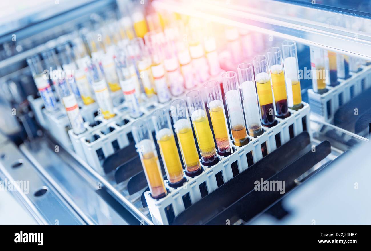 Closeup samples in robot machine for biochemical automatic testing ...