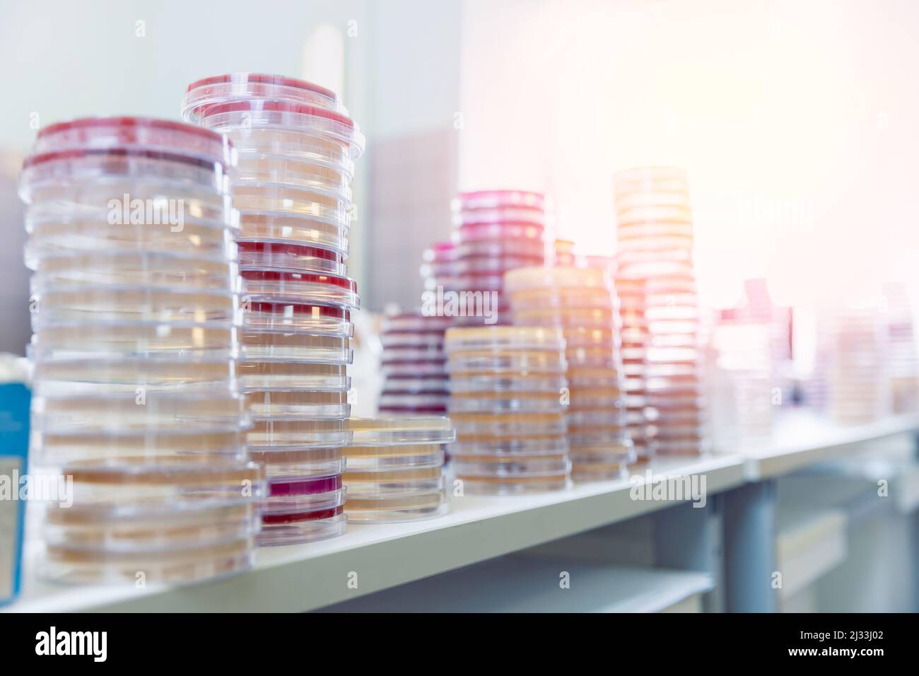 Microbiology concept, hand of medical worker on agar plate culture ...
