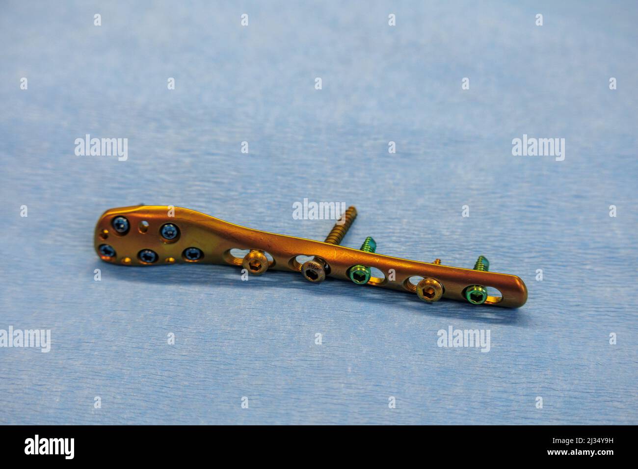 a titanium surgical plate and titanium screws for the treatment of a ...