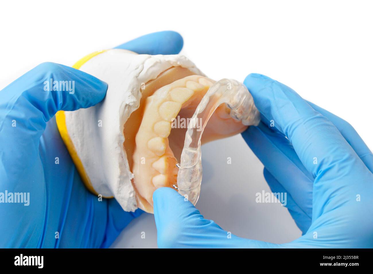 Dentist adjusting a dental splint, a device made for occlusion problems ...
