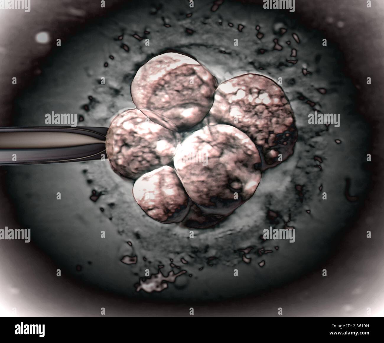 IVF embryo, light micrograph Stock Photo - Alamy