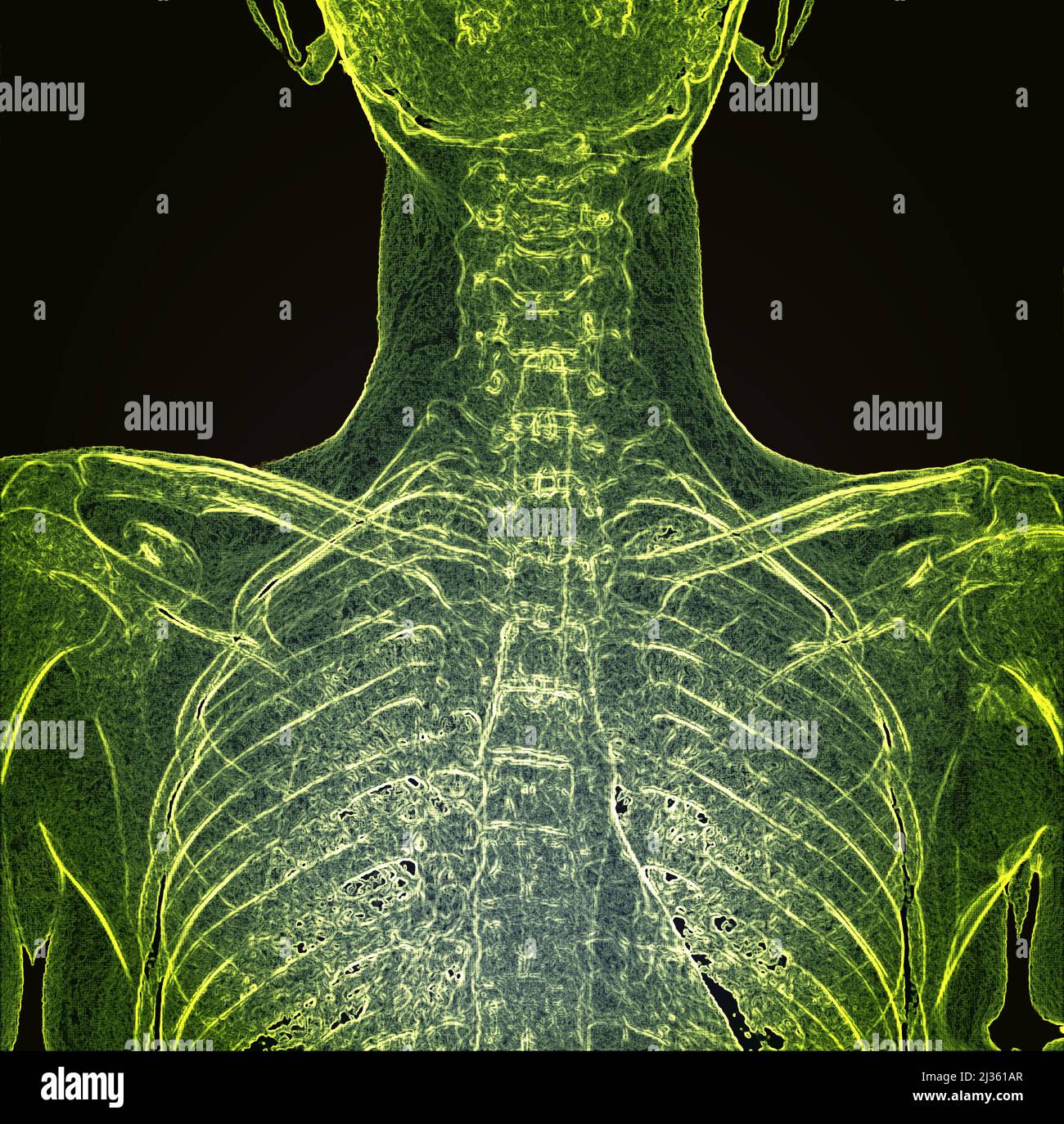 Healthy rib cage, X-ray Stock Photo - Alamy