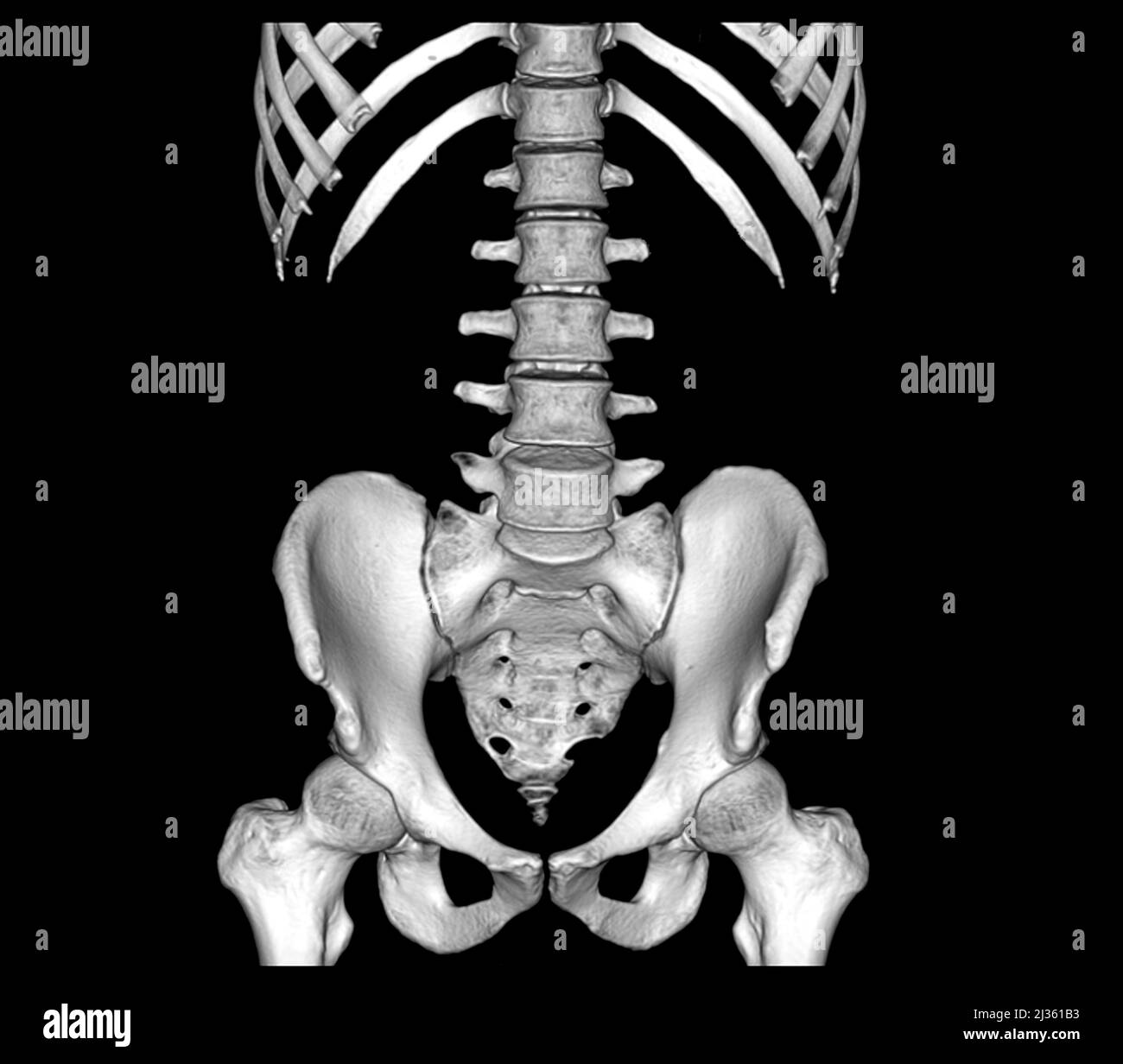 Healthy spine and pelvis, CT scan Stock Photo - Alamy