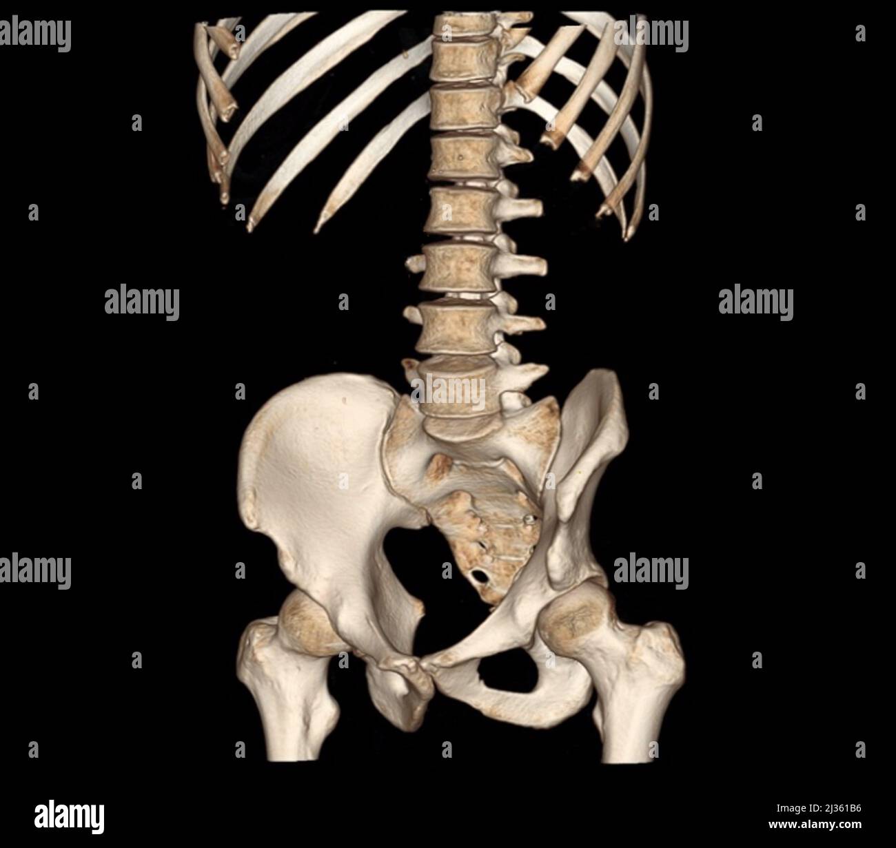 Healthy lower spine, CT scan Stock Photo - Alamy