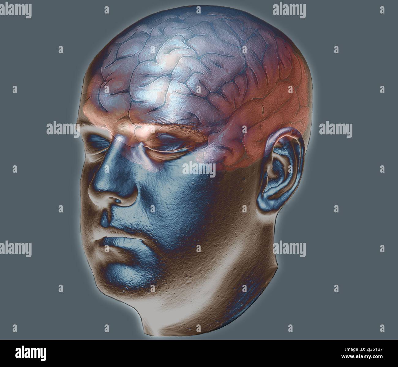 Normal brain, 3D CT scan Stock Photo - Alamy