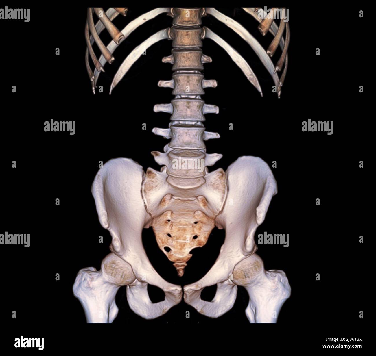 Healthy spine and pelvis, CT scan Stock Photo - Alamy