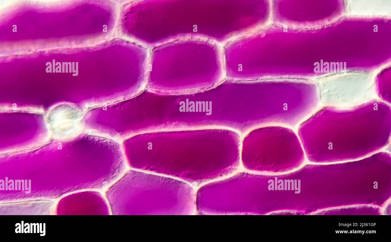 Onion epidermis plasmolysis, light micrograph Stock Photo - Alamy