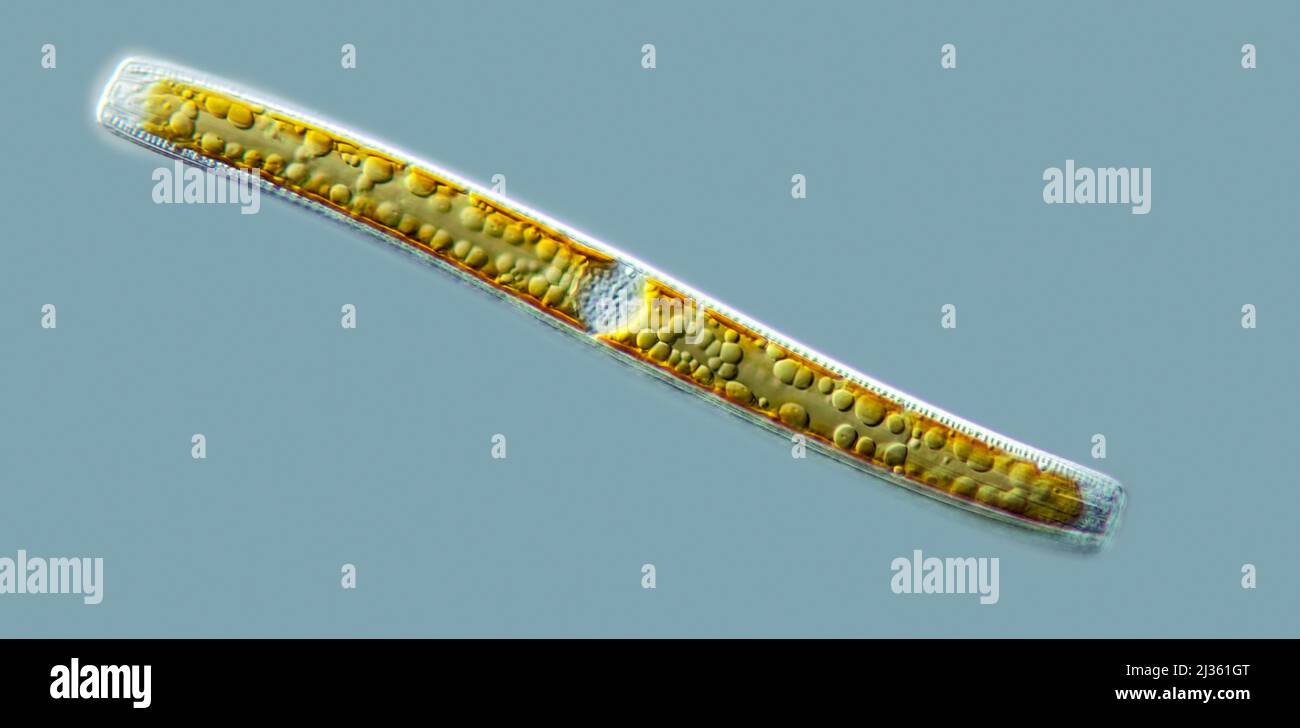 Nitzschia freshwater diatom, light micrograph Stock Photo - Alamy