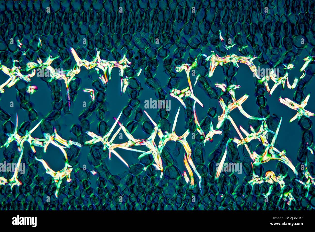 Umbrella pine leaf, light micrograph Stock Photo - Alamy