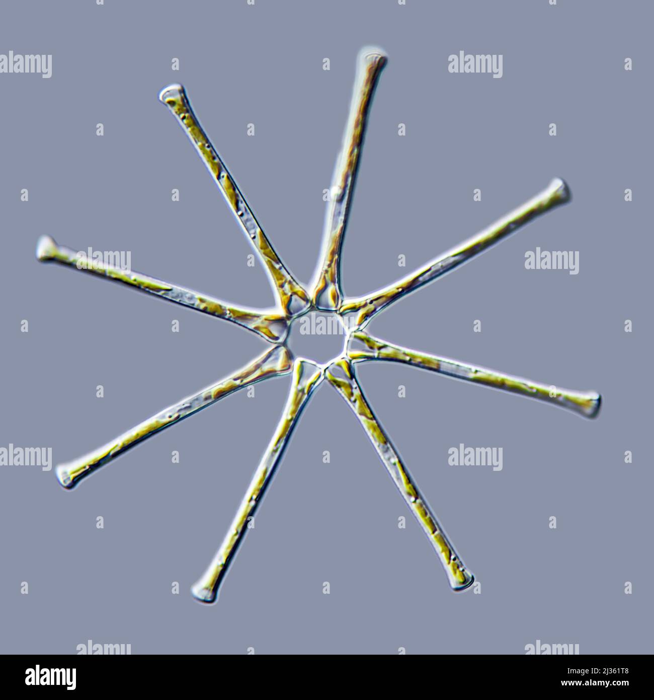 Diploneis freshwater diatom colony, light micrograph Stock Photo - Alamy