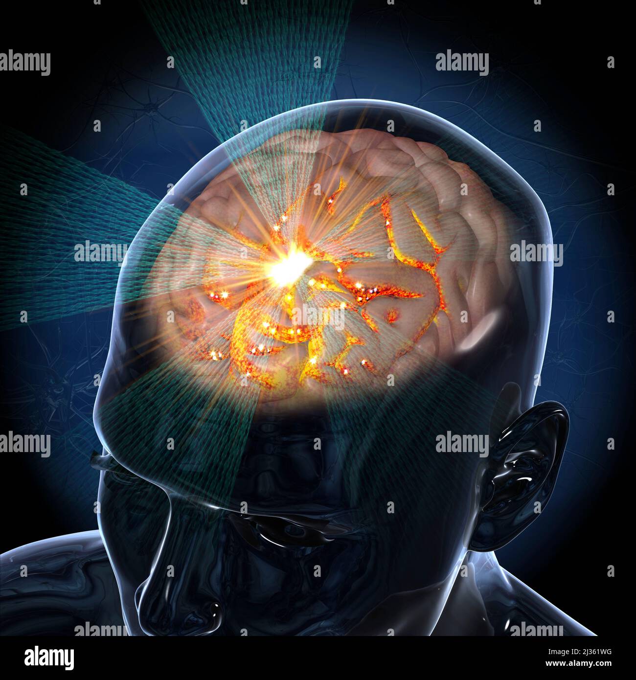 Brain activity, conceptual illustration Stock Photo - Alamy