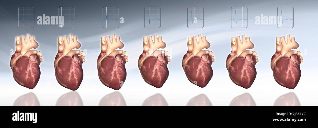 Heartbeat stages, illustration Stock Photo - Alamy