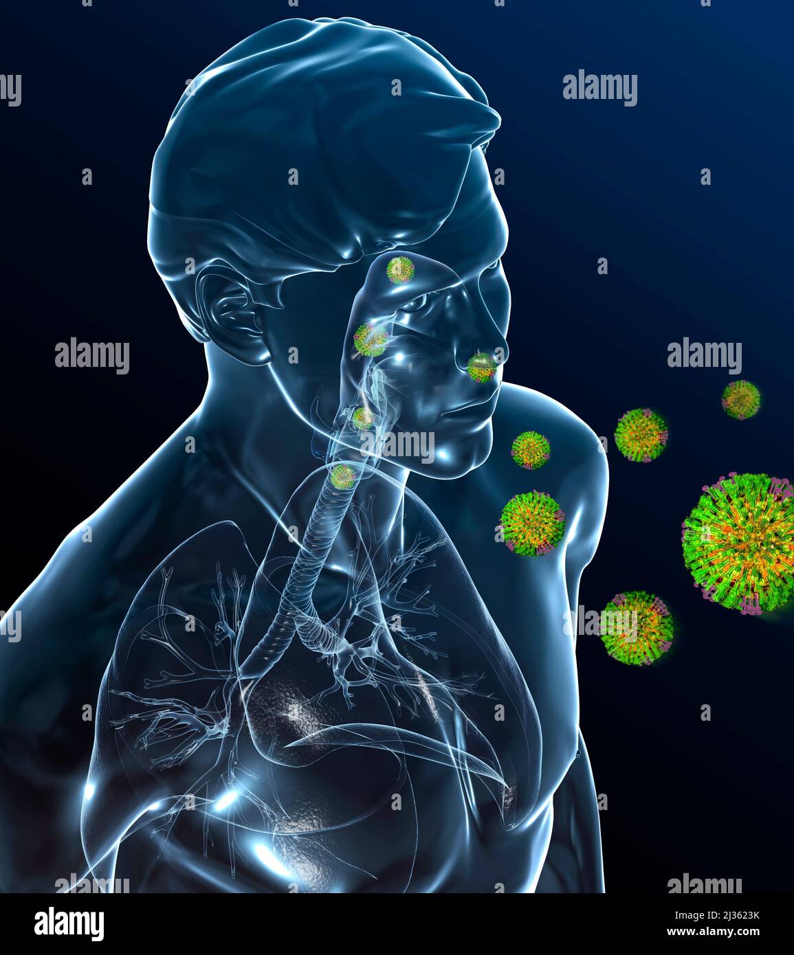 Viral respiratory infection, illustration Stock Photo - Alamy