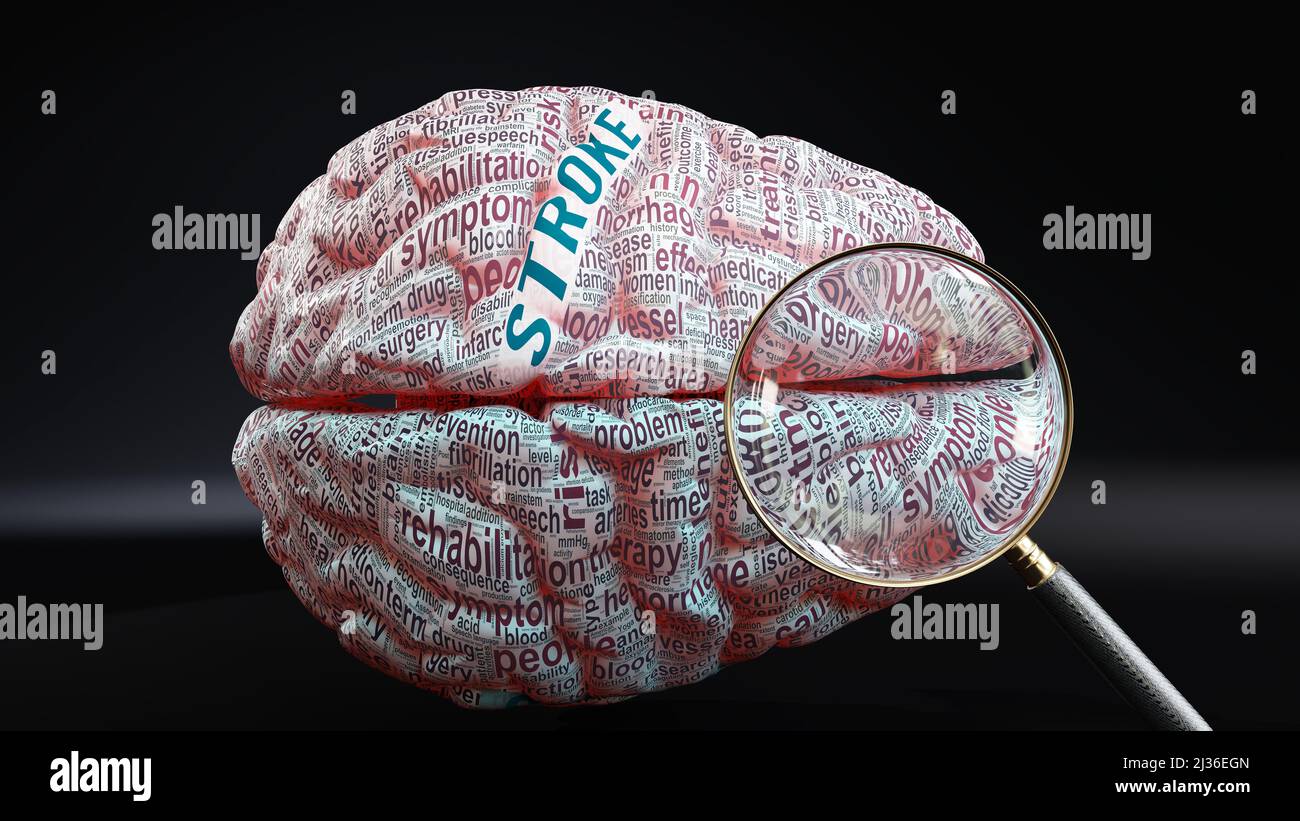 Human Brain After Stroke