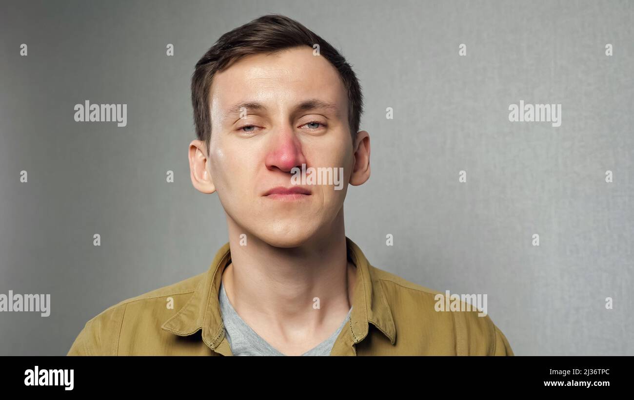 Sick man with red nose standing on grey background Stock Photo - Alamy