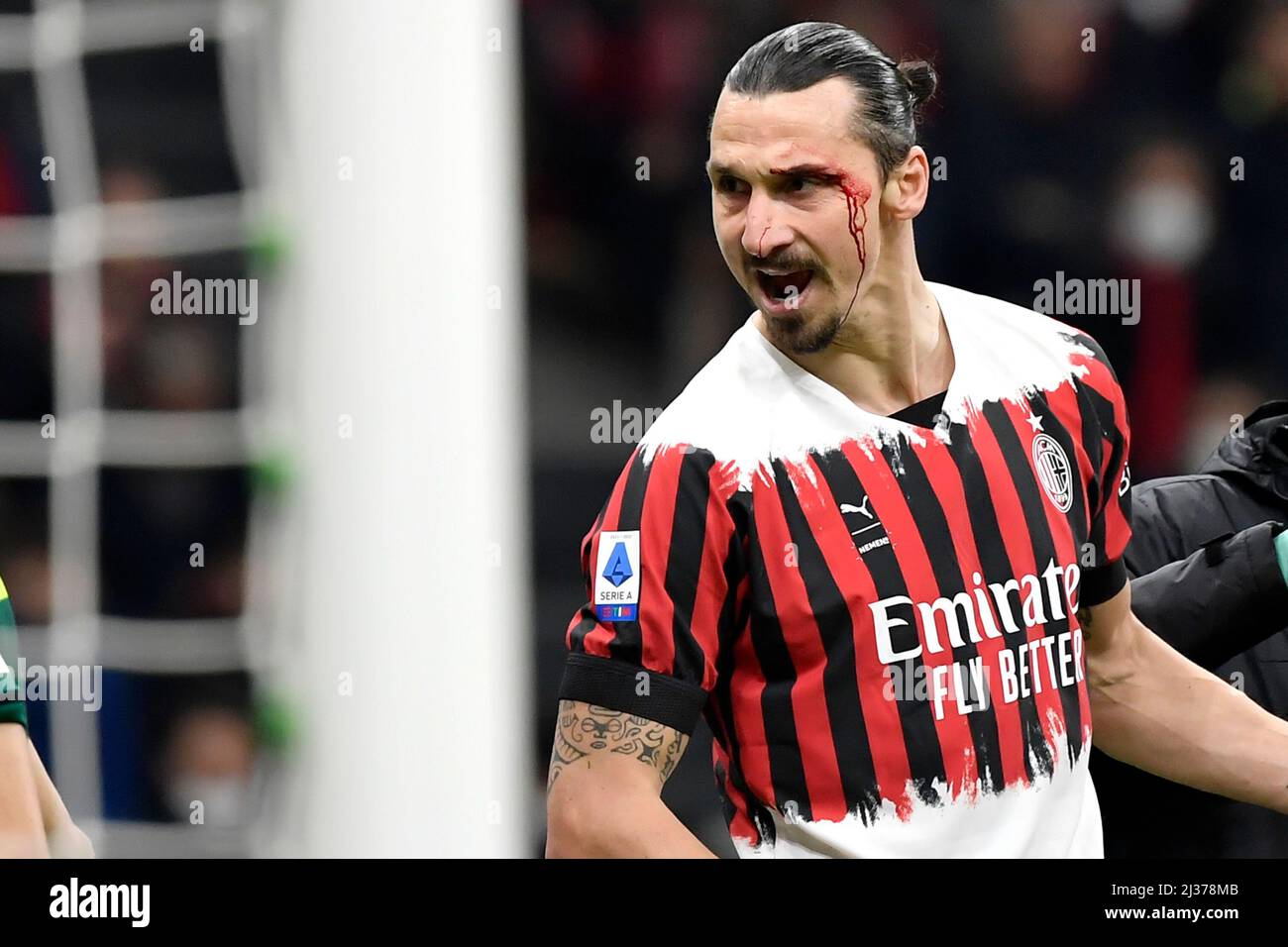 Soccer football blood bleeding 2022 hi-res stock photography and images ...