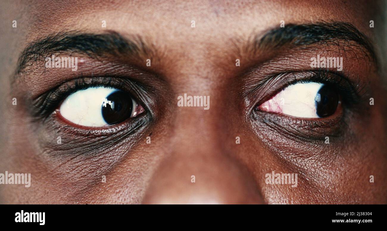 Extreme face close-up, macro eyes of black African man looking sideways ...