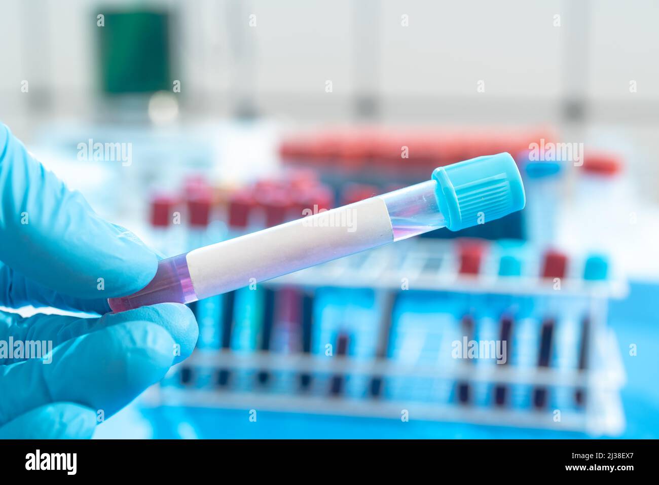 Test tube with empty label to laboratory research Stock Photo - Alamy