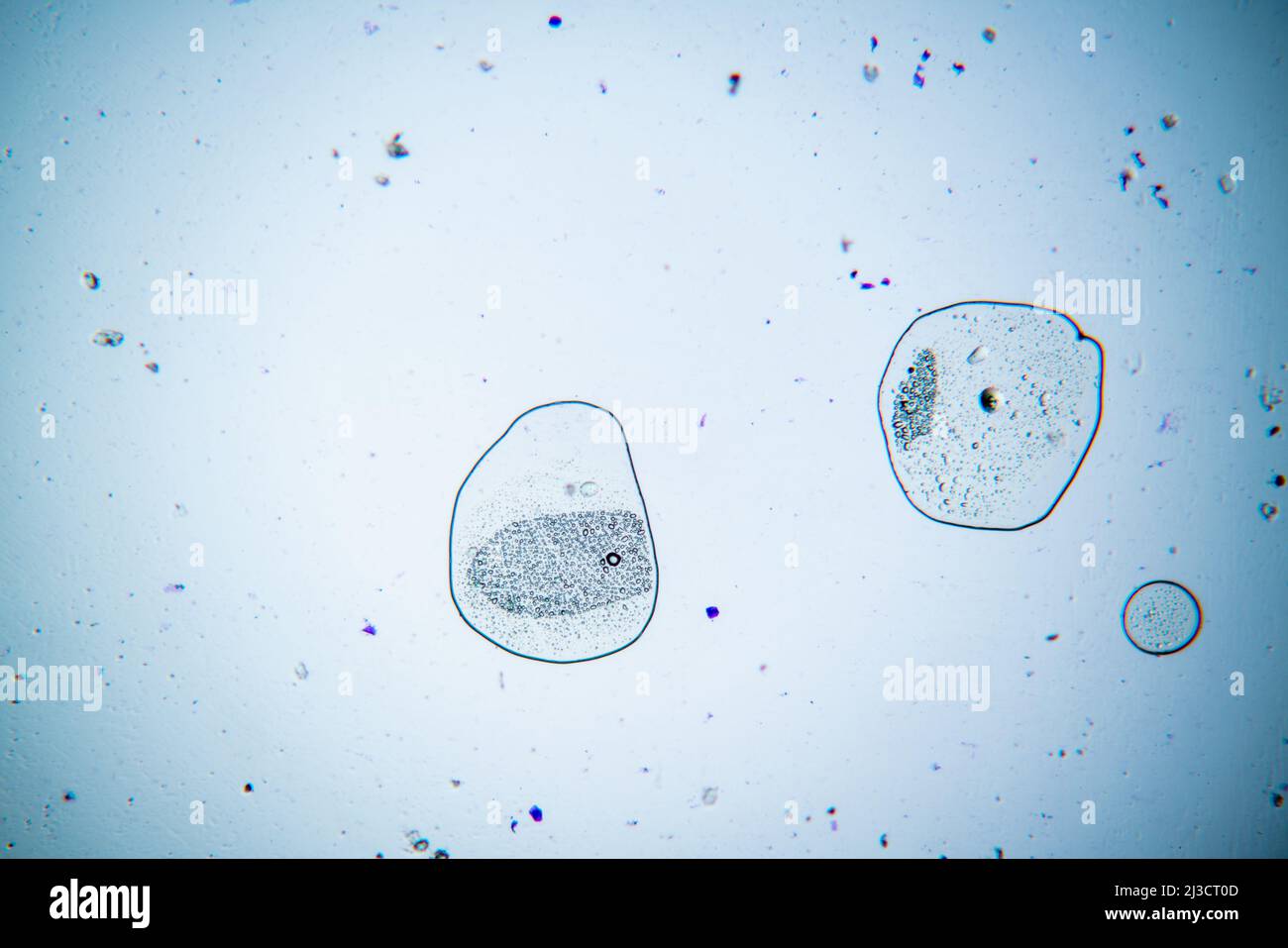 Biological fluid at a crime scene under a microscope as evidence of a ...