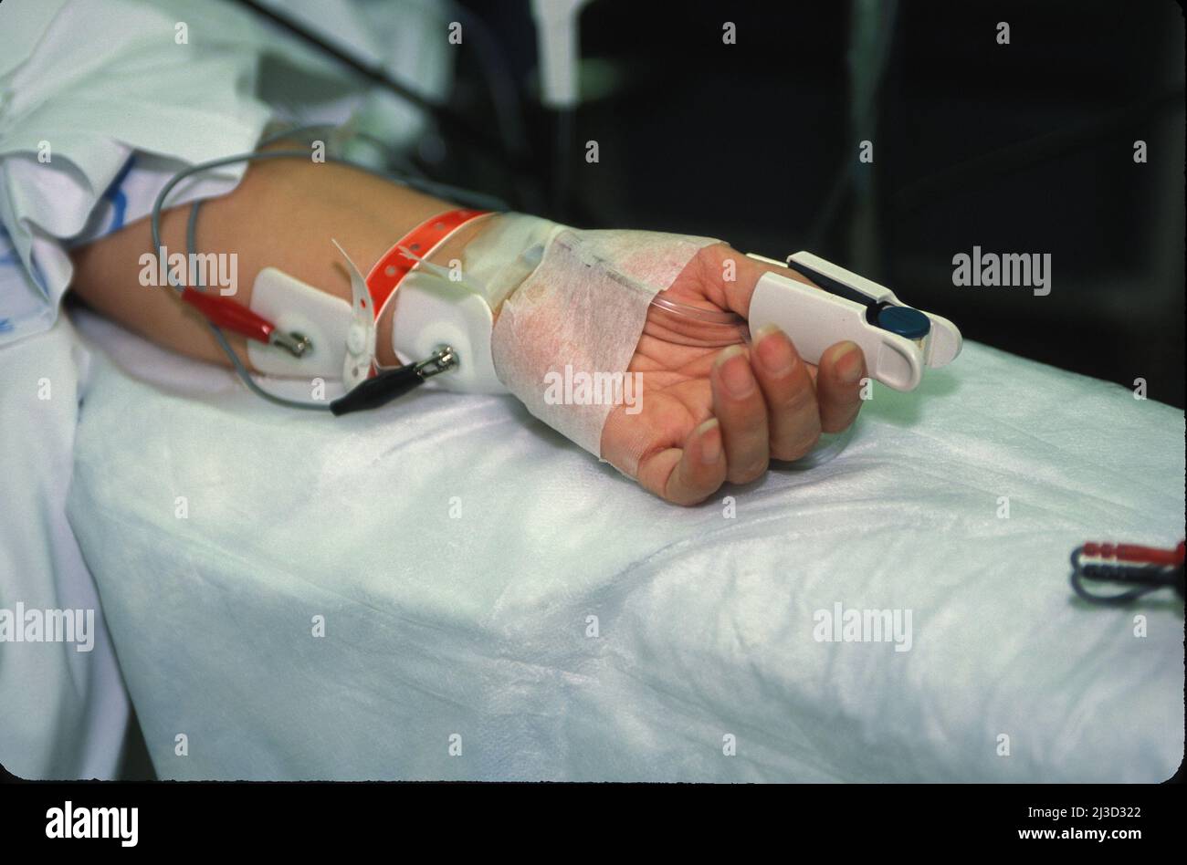 Patient in operating room wired to keep track of vital signs during ...
