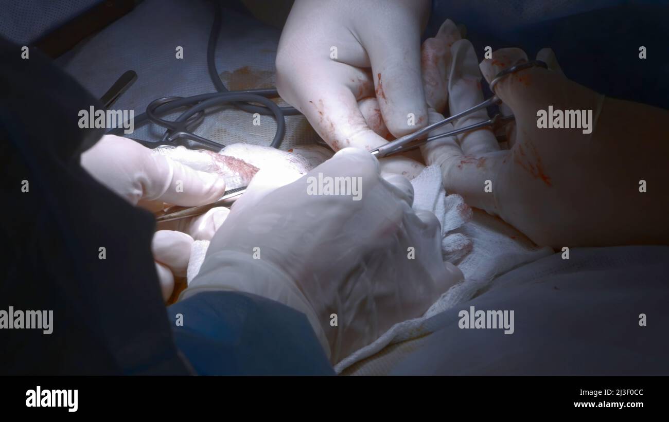 Hands surgical team working instruments hi-res stock photography and ...