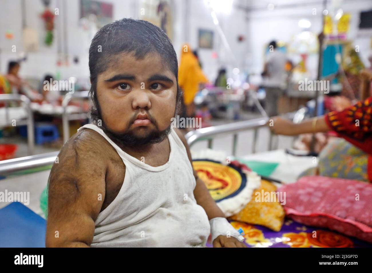Dhaka, Bangladesh - March 06, 2022: Argina, a three-and-a-half-year-old ...