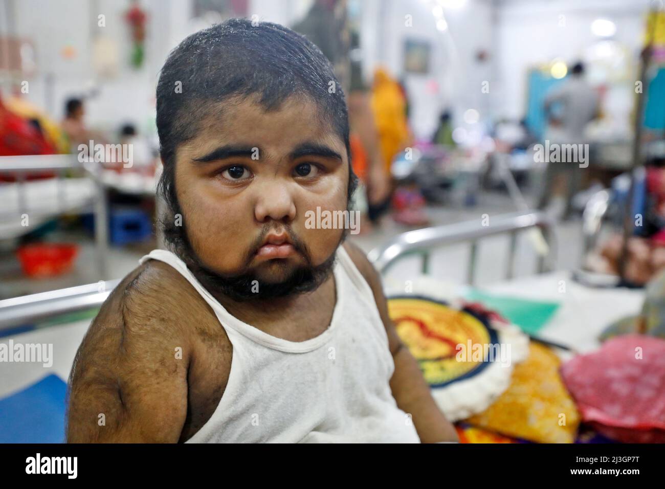 Dhaka, Bangladesh - March 06, 2022: Argina, a three-and-a-half-year-old ...