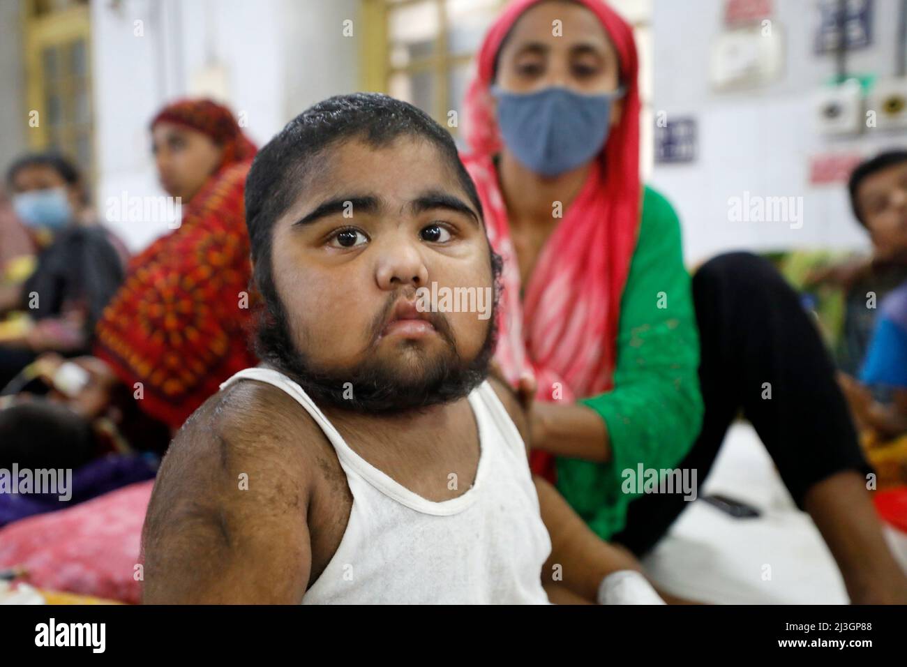 Dhaka, Bangladesh - March 06, 2022: Argina, a three-and-a-half-year-old ...