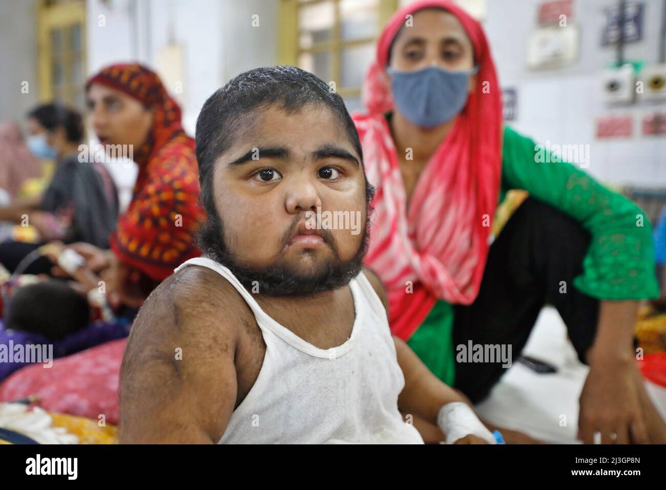 Dhaka, Bangladesh - March 06, 2022: Argina, a three-and-a-half-year-old ...