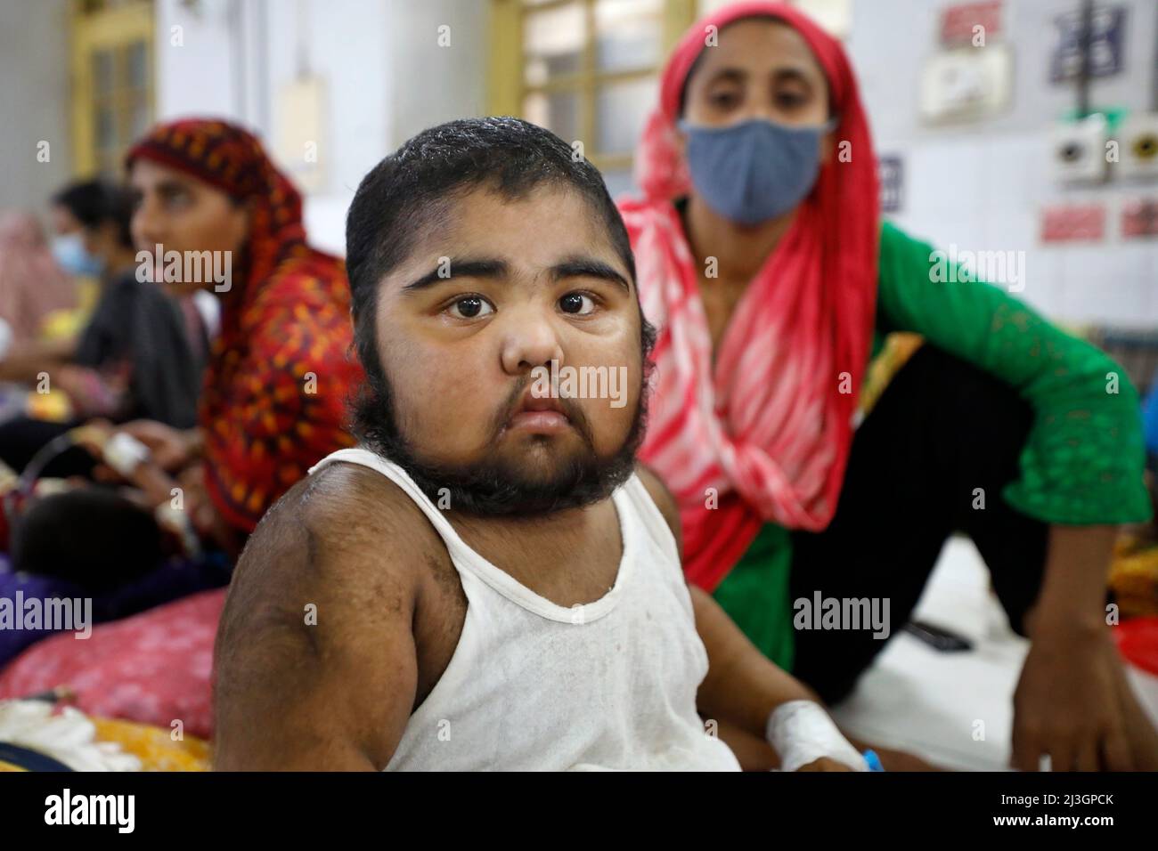 Dhaka, Bangladesh - March 06, 2022: Argina, a three-and-a-half-year-old ...