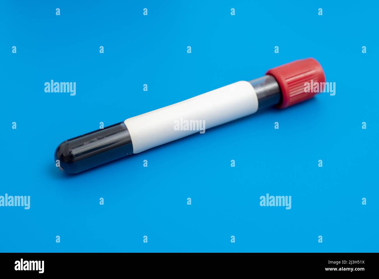 Test tube with empty label to biological sample for medical laboratory ...