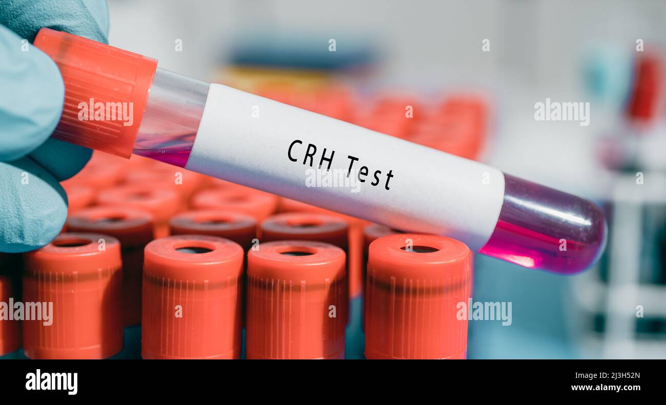 Hypothalamus Corticotropin releasing hormone CRH Test Regulates ...