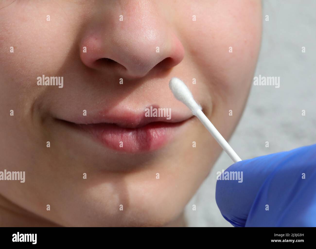 nose of the young girl while a nasal swab test is performed for the ...