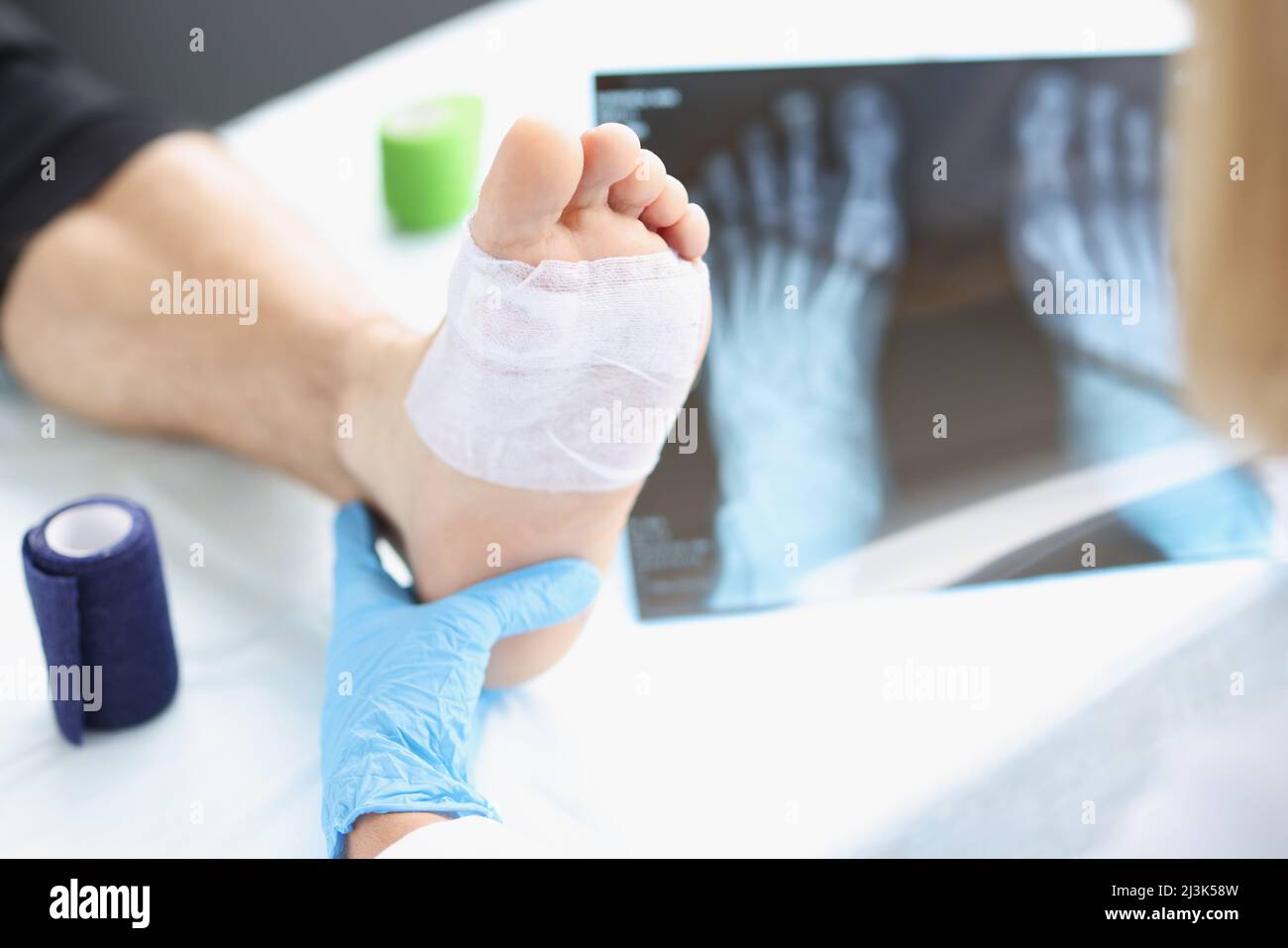 Traumatologist holds MRI scan of feet of male leg closeup Stock Photo ...
