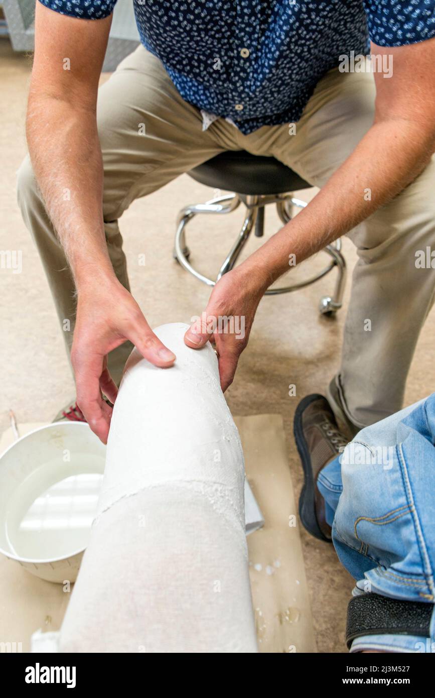 Amputation amputated hi-res stock photography and images - Alamy